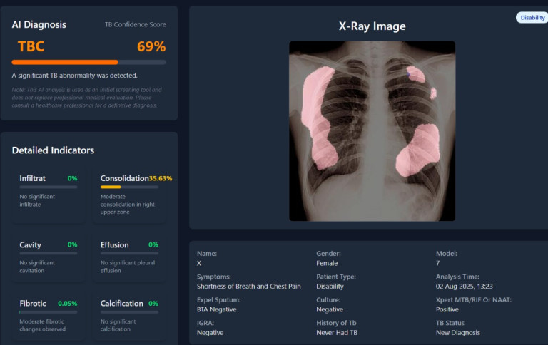 UGM Develops Indonesia’s First AI-Powered Tuberculosis Screening App ...