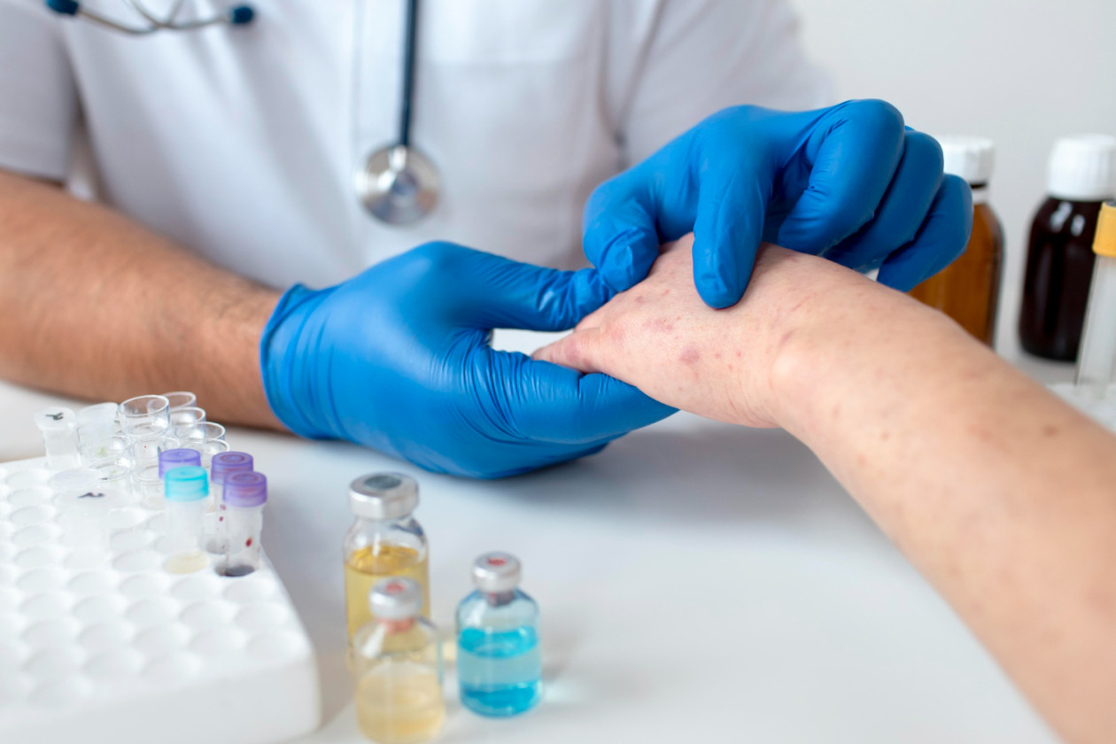 Amid Rising Measles Cases, Expert at Universitas Gadjah Mada Urges ...